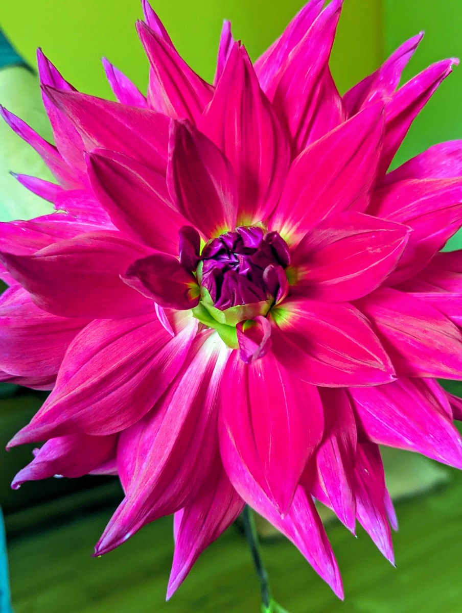 Hard Truths about Organ Transplant – Dawn Levitt, Author